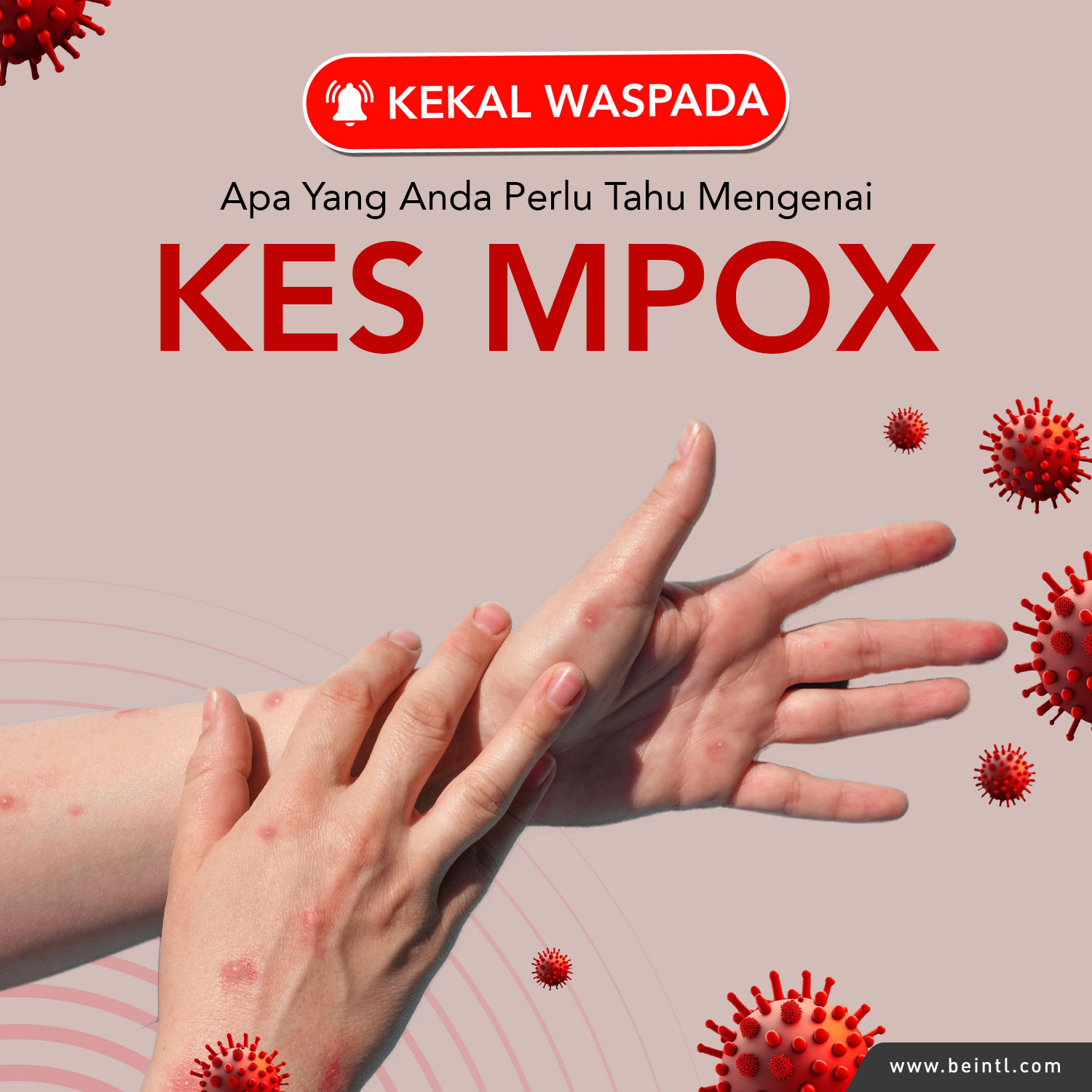 KEKAL WASPADA: Apa Yang Anda Perlu Tahu Mengenai Kes Mpox Terkini di Malaysia - BE International ...
